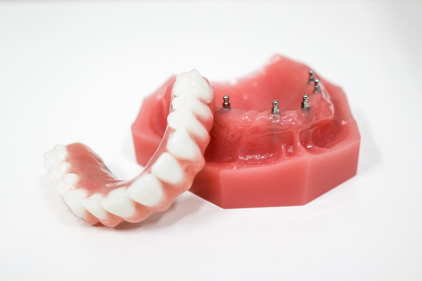 Mini Implant Dentures in North Carolina | Reserve una consulta gratuita